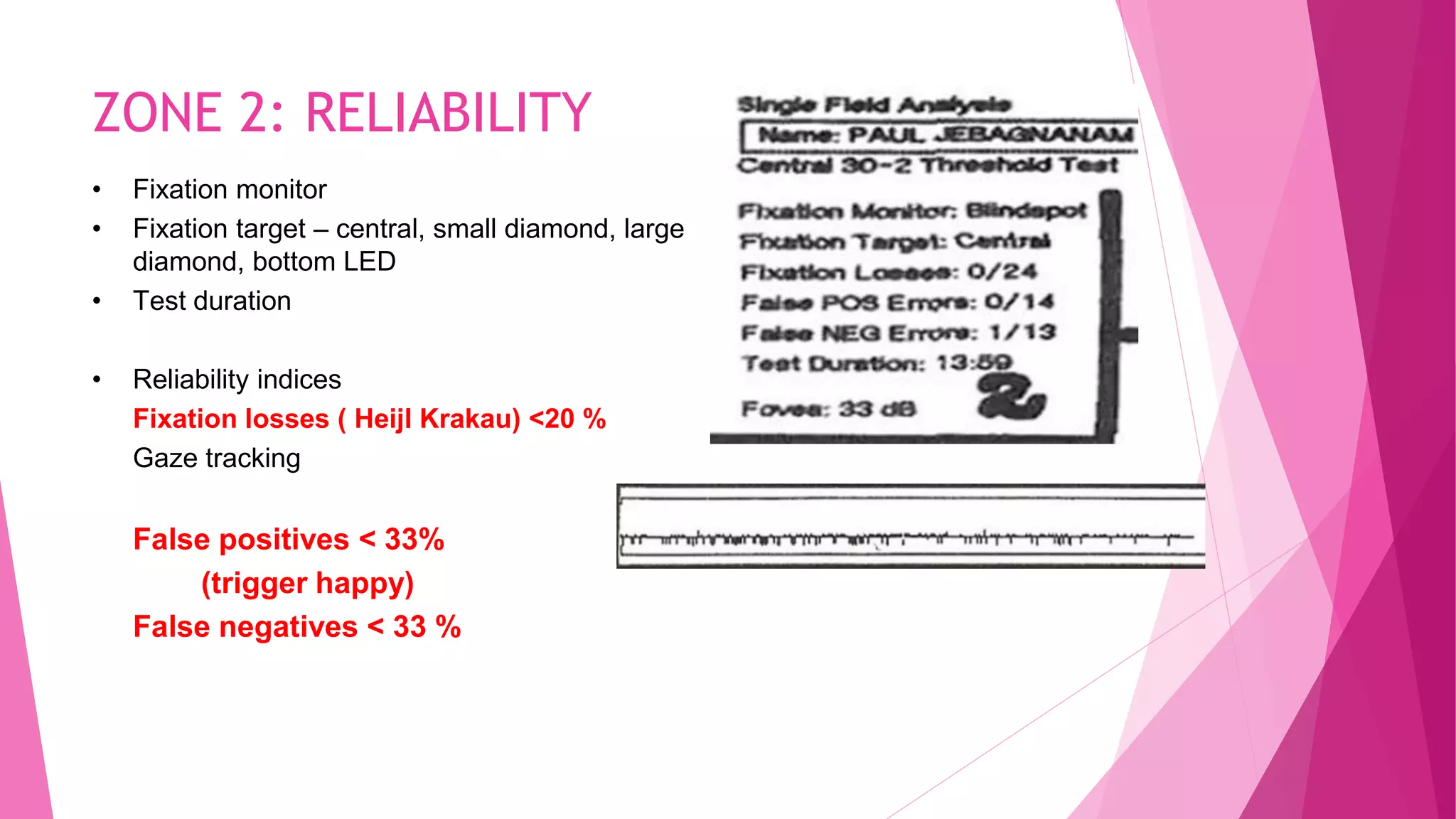 Basic approach on hvf | PPTX
