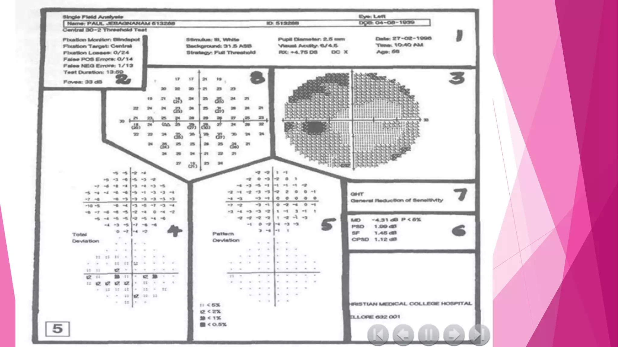 Basic approach on HVF | PPTX