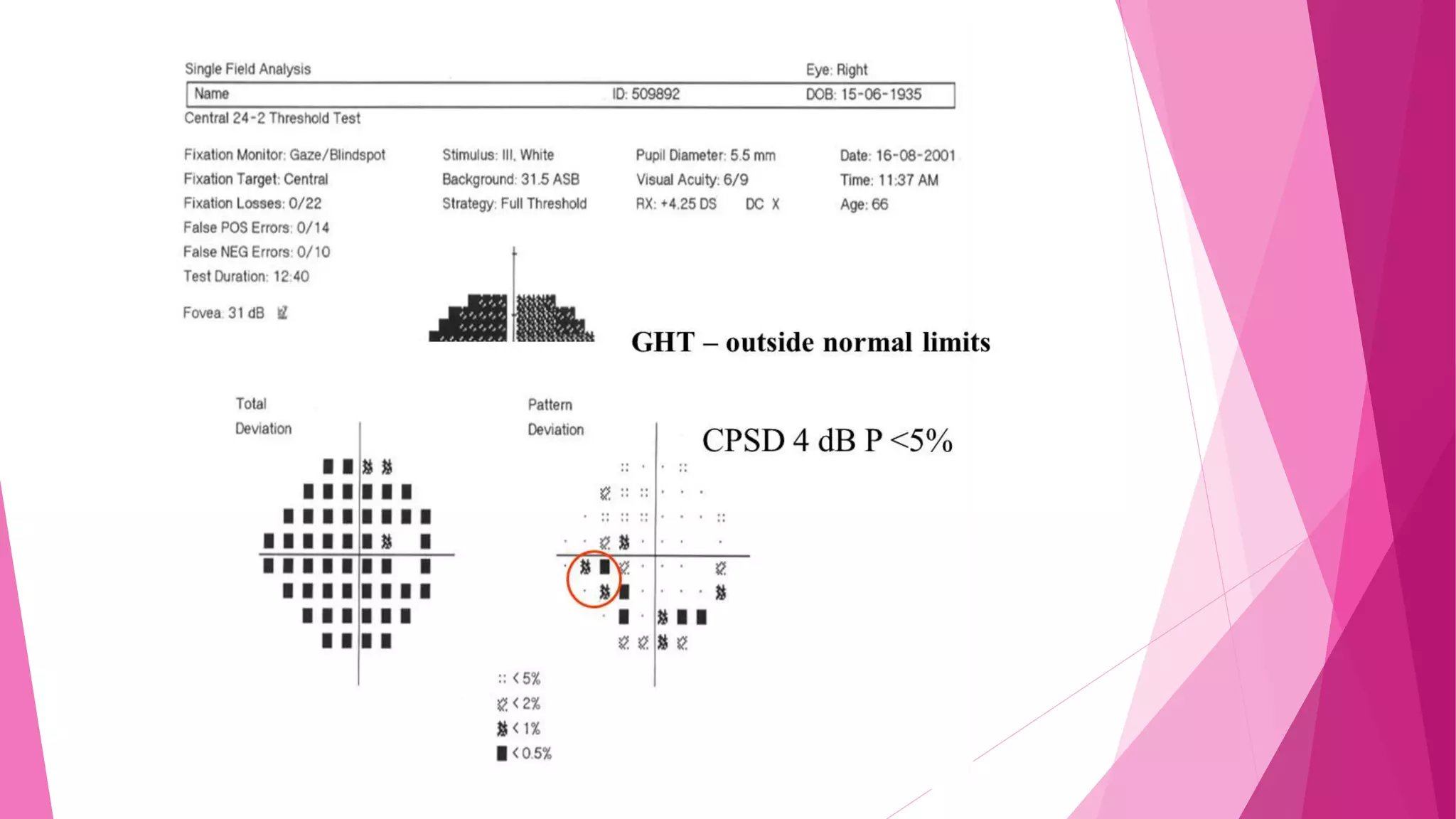 Basic approach on HVF | PPTX