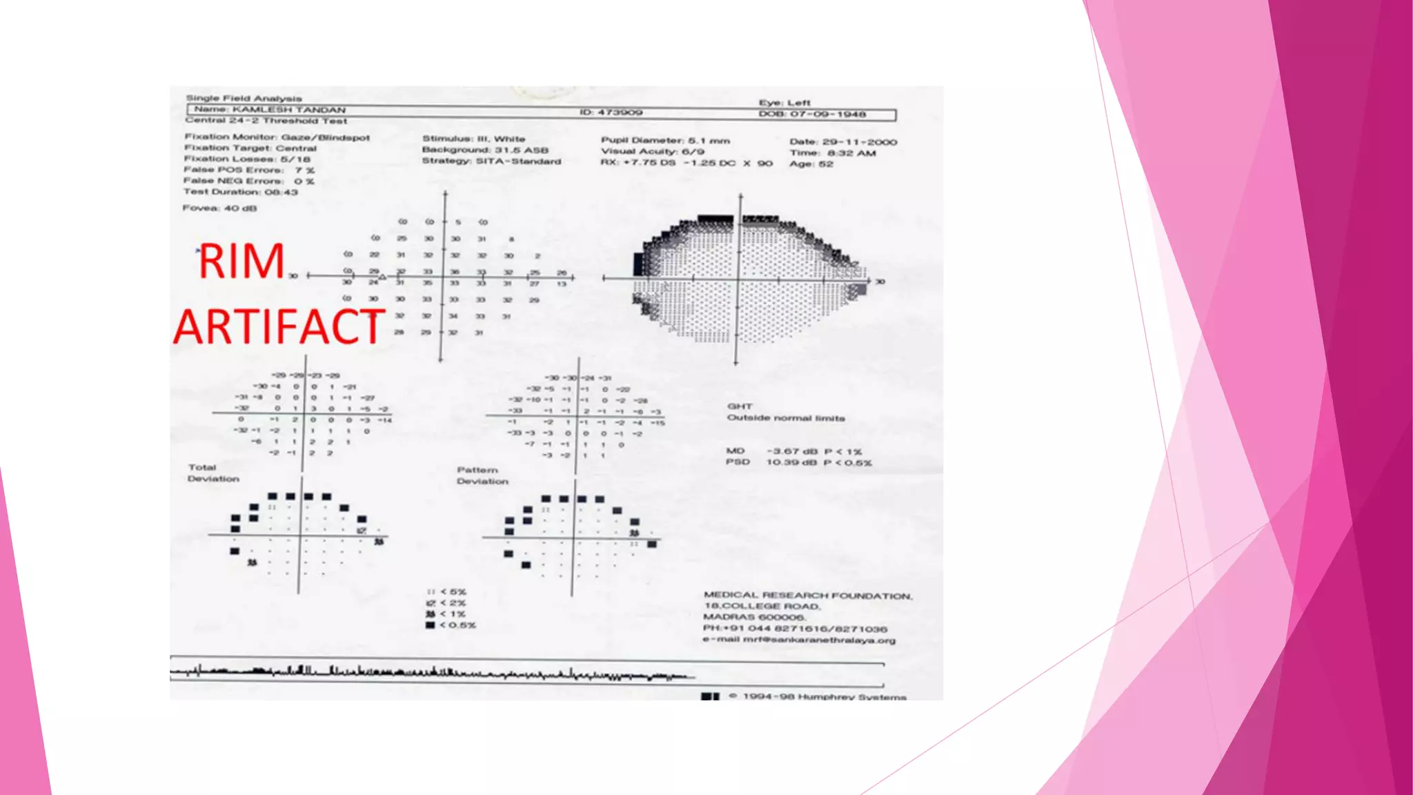 Basic approach on HVF | PPTX