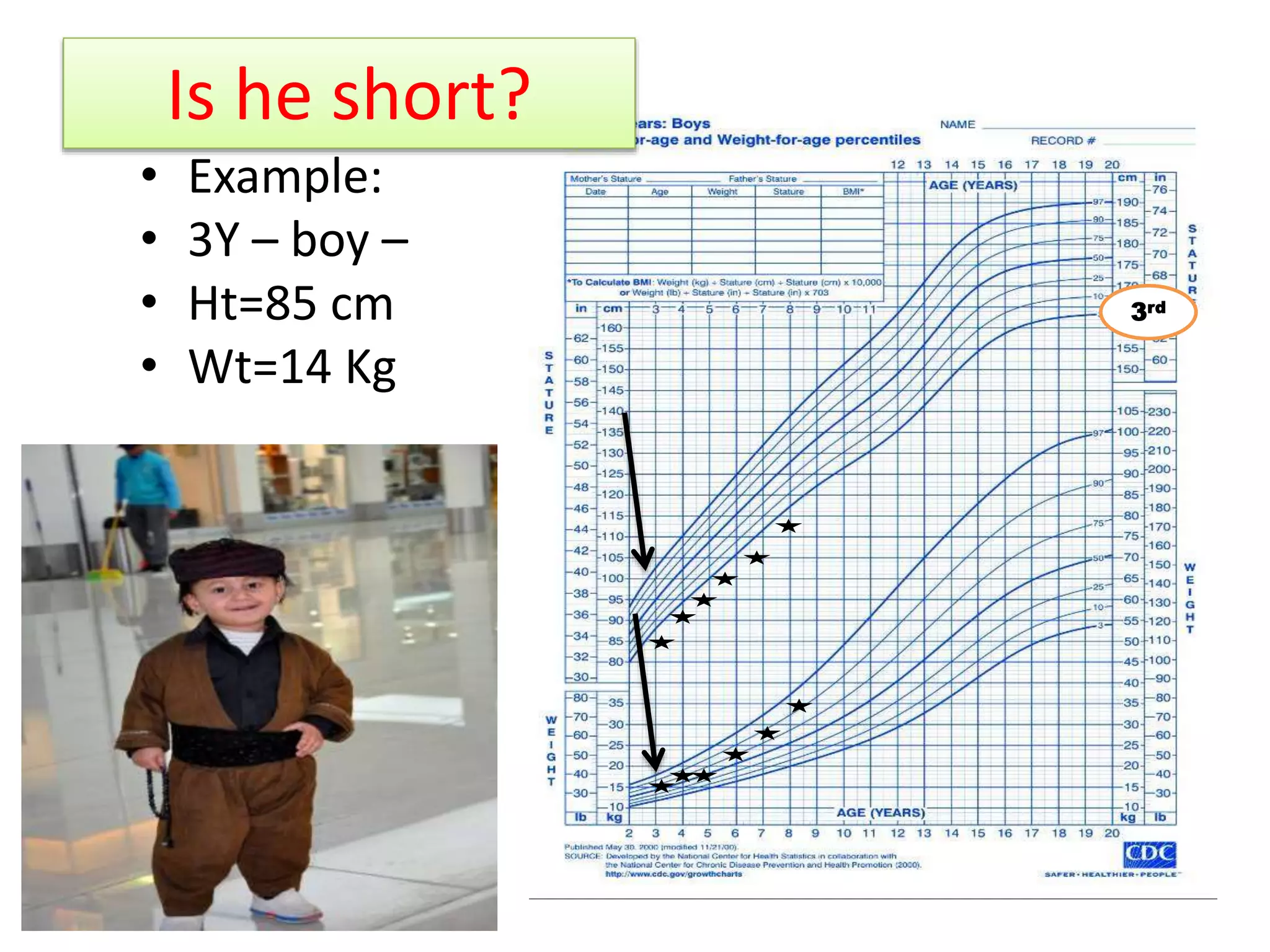 Basic approach on short stature in children | PPTX