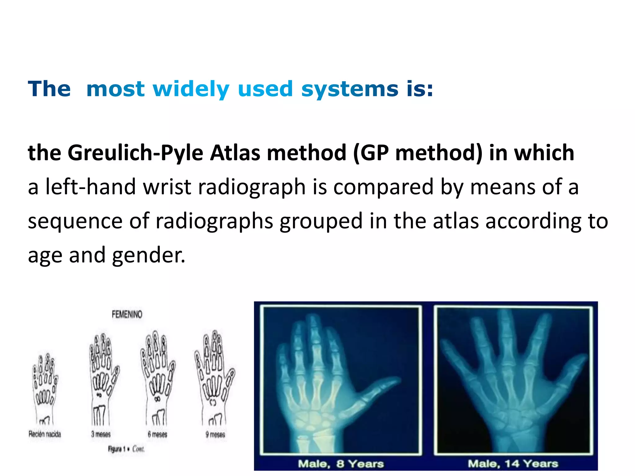 Basic approach on short stature in children | PPTX