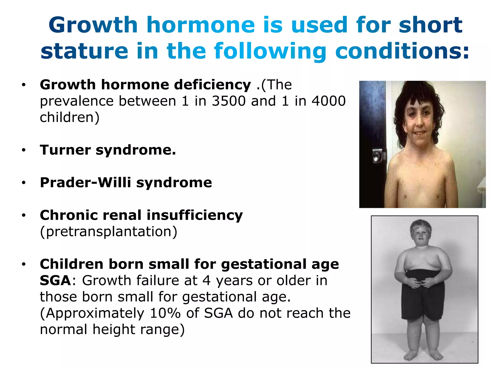 Basic approach on short stature in children | PPTX