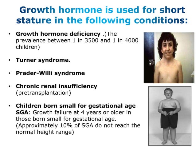 Basic approach on short stature in children | PPTX | Endocrine and ...
