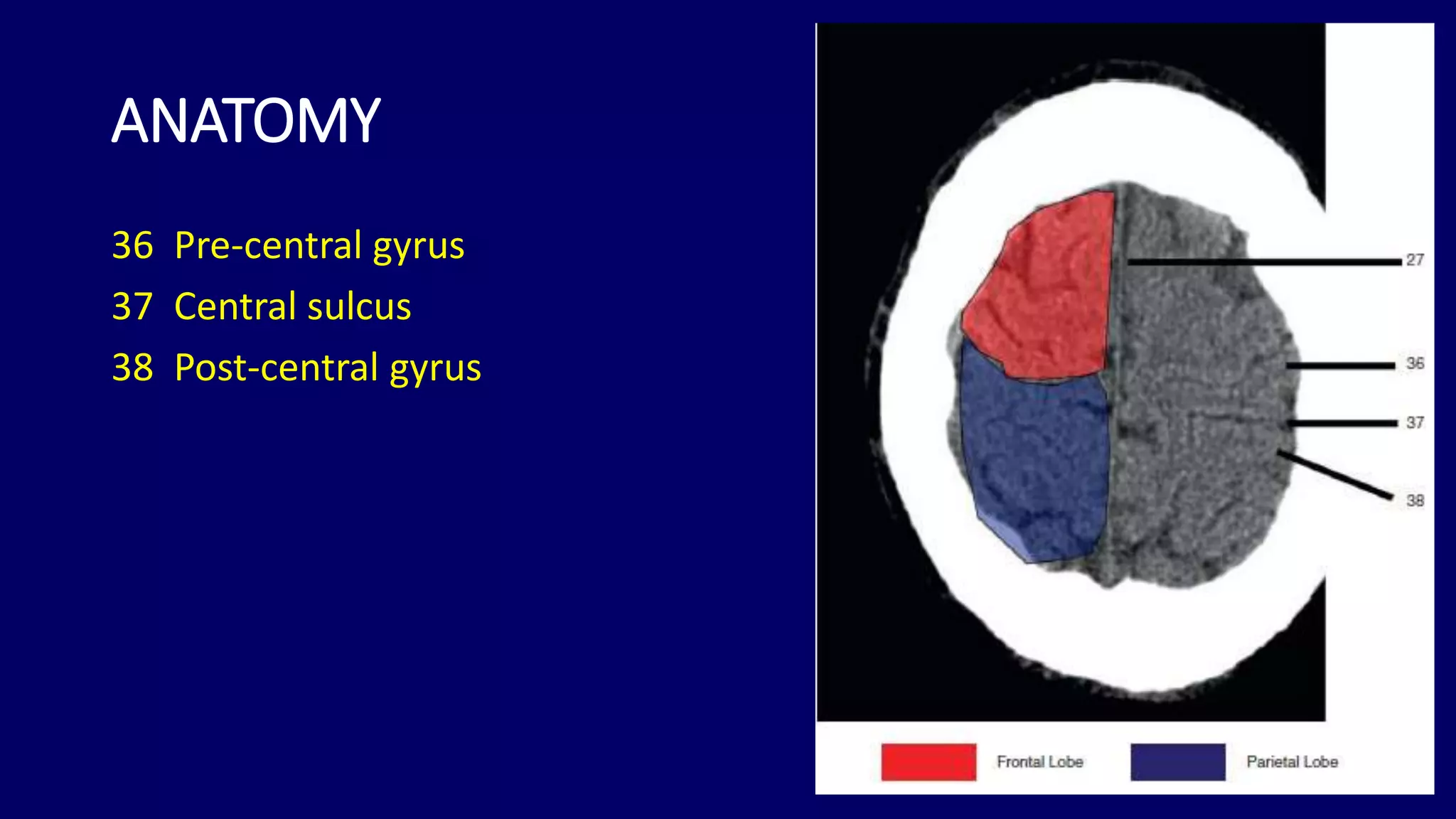 Basic approach to brain CT Dr. Muhammad Bin Zulfiqar | PPTX