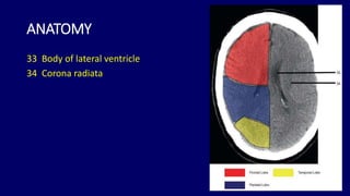 Basic approach to brain CT Dr. Muhammad Bin Zulfiqar | PPTX