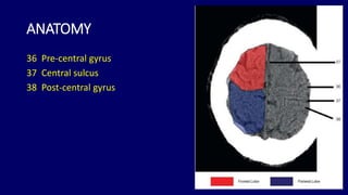 Basic approach to brain CT Dr. Muhammad Bin Zulfiqar | PPTX