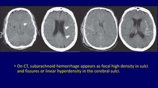 Basic approach to brain CT Dr. Muhammad Bin Zulfiqar | PPTX