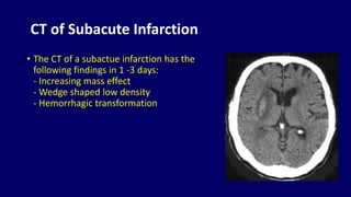 Basic approach to brain CT Dr. Muhammad Bin Zulfiqar | PPTX