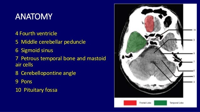 Basic approach to brain CT Dr. Muhammad Bin Zulfiqar