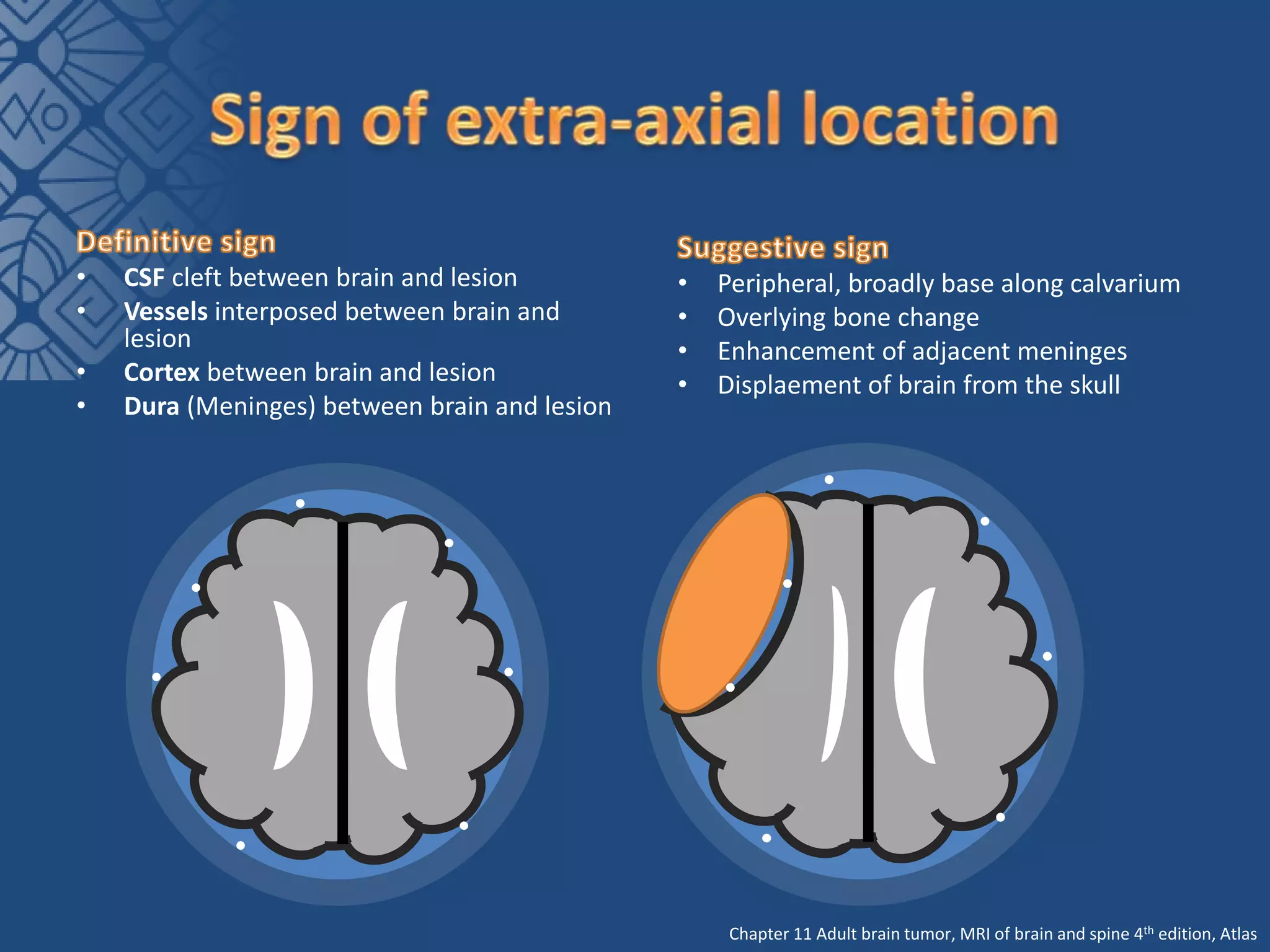 Basic approach to brain tumor | PPTX