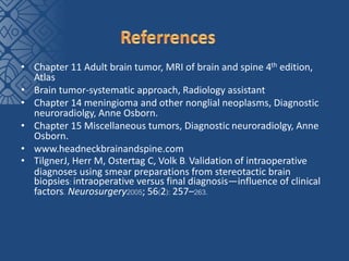 Basic approach to brain tumor | PPTX