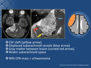 Basic approach to brain tumor | PPTX