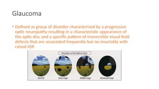 Basic approach to Glaucoma patient.pptx