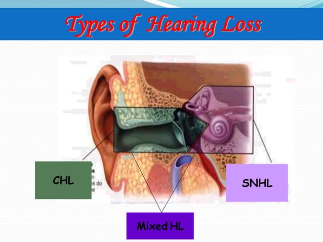 Basic audiological evaluation.pptx