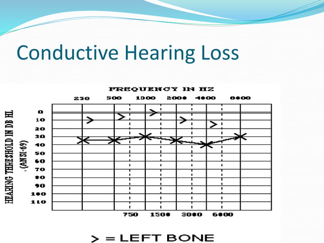 Basic audiological evaluation.pptx