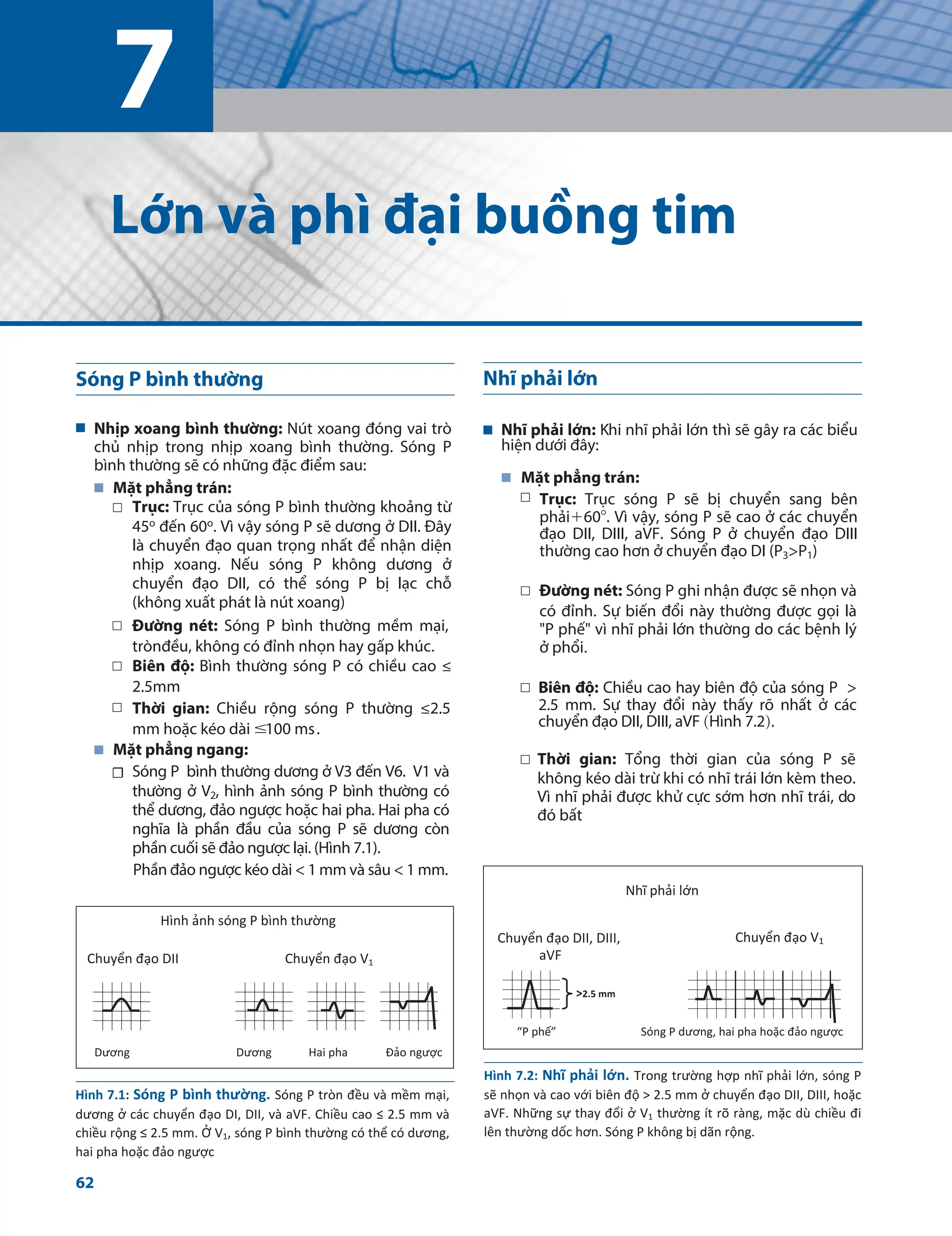 Basic Bedside Electrocardiography (Tiếng Việt).pdf