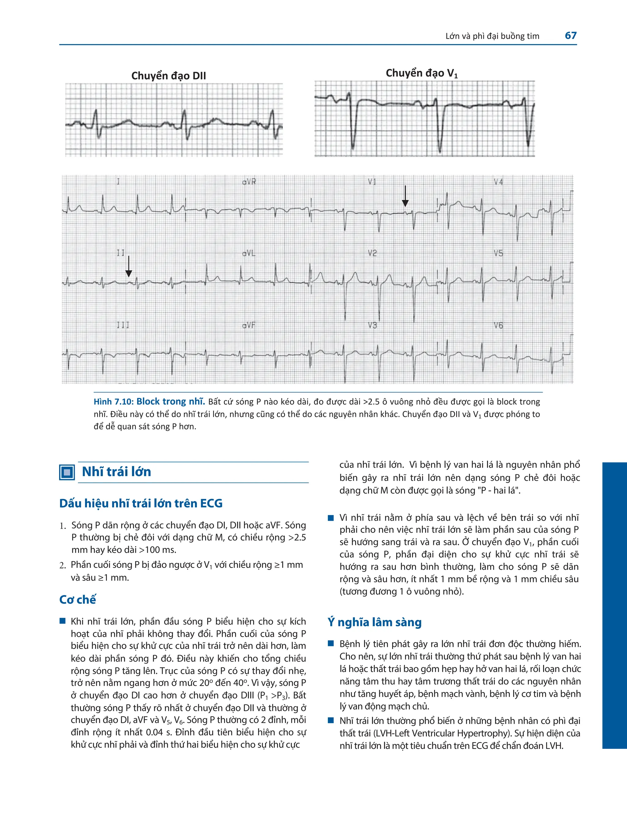 Basic Bedside Electrocardiography (Tiếng Việt).pdf
