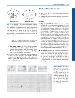 Basic Bedside Electrocardiography (Tiếng Việt).pdf