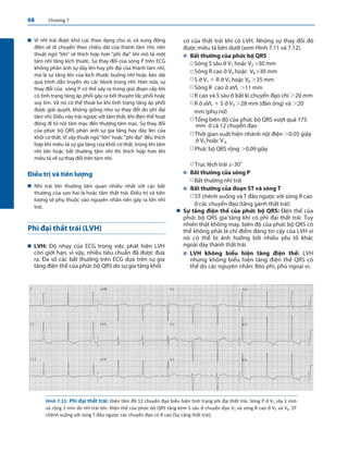Basic Bedside Electrocardiography (Tiếng Việt).pdf