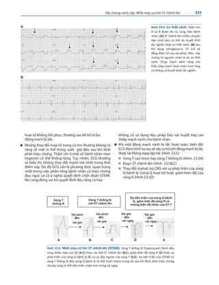 Basic Bedside Electrocardiography (Tiếng Việt).pdf