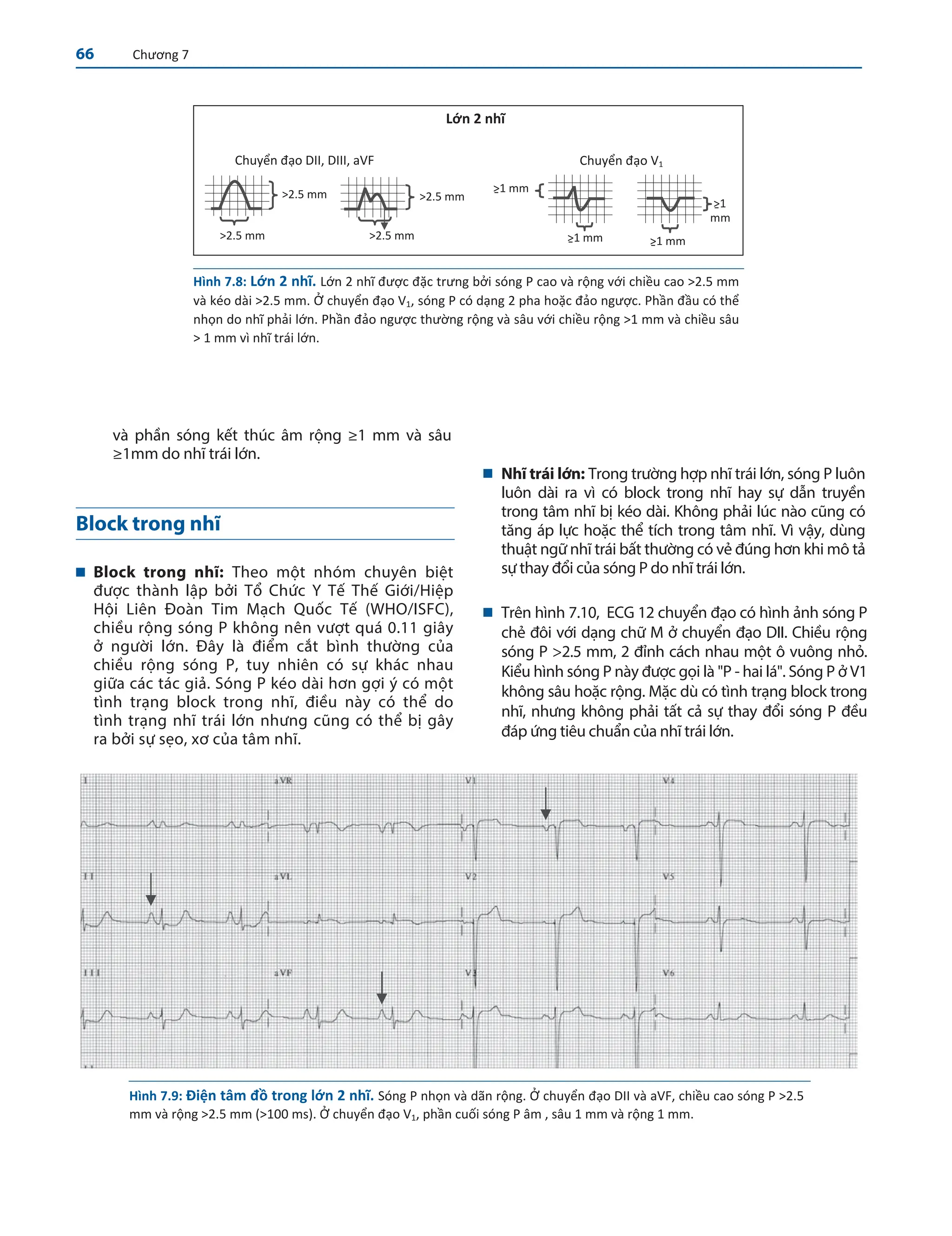 Basic Bedside Electrocardiography (Tiếng Việt).pdf