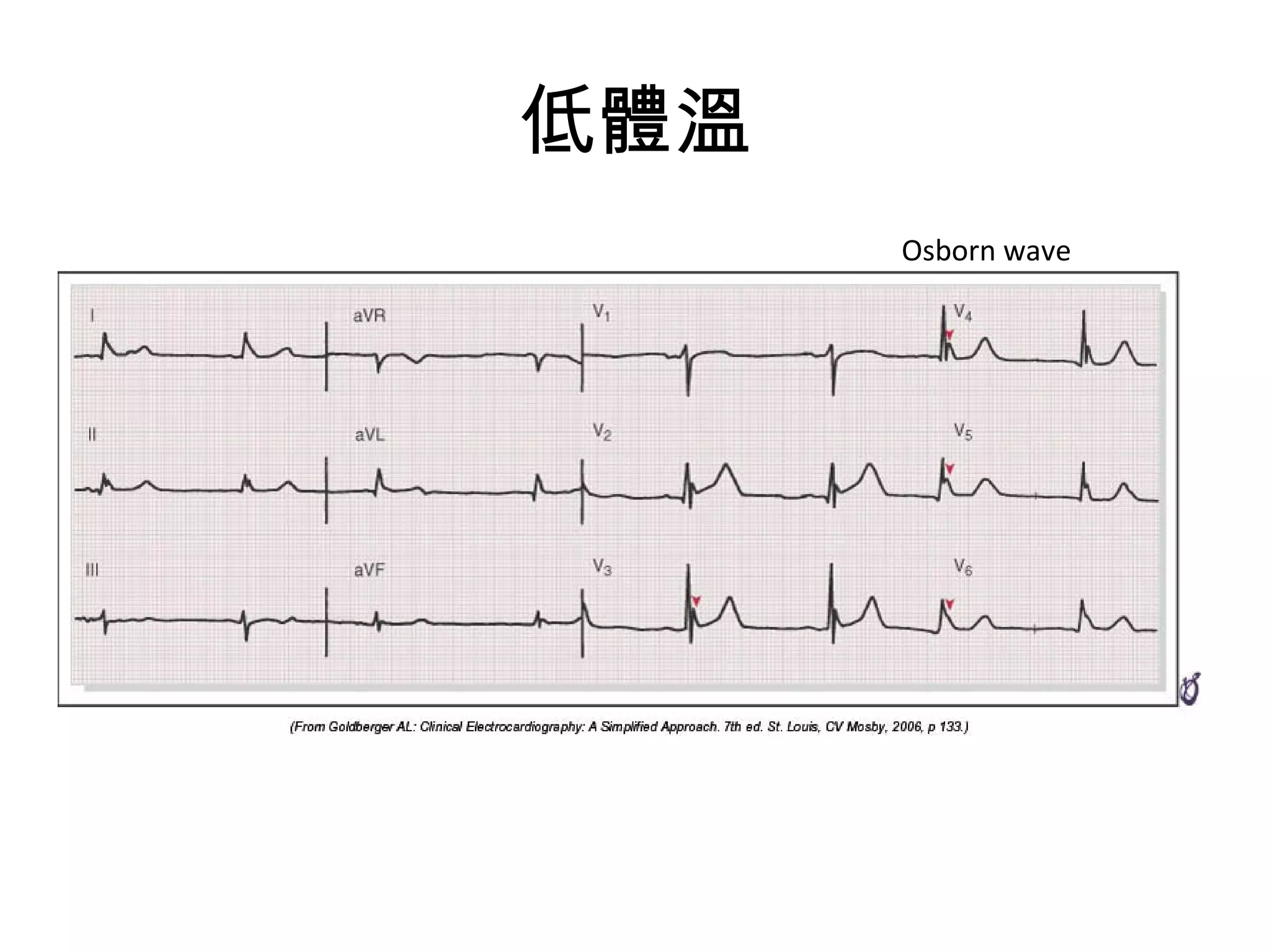 Basic Cardiac Electrophysiology and ECG Concepts_20120916_南區 | PPT