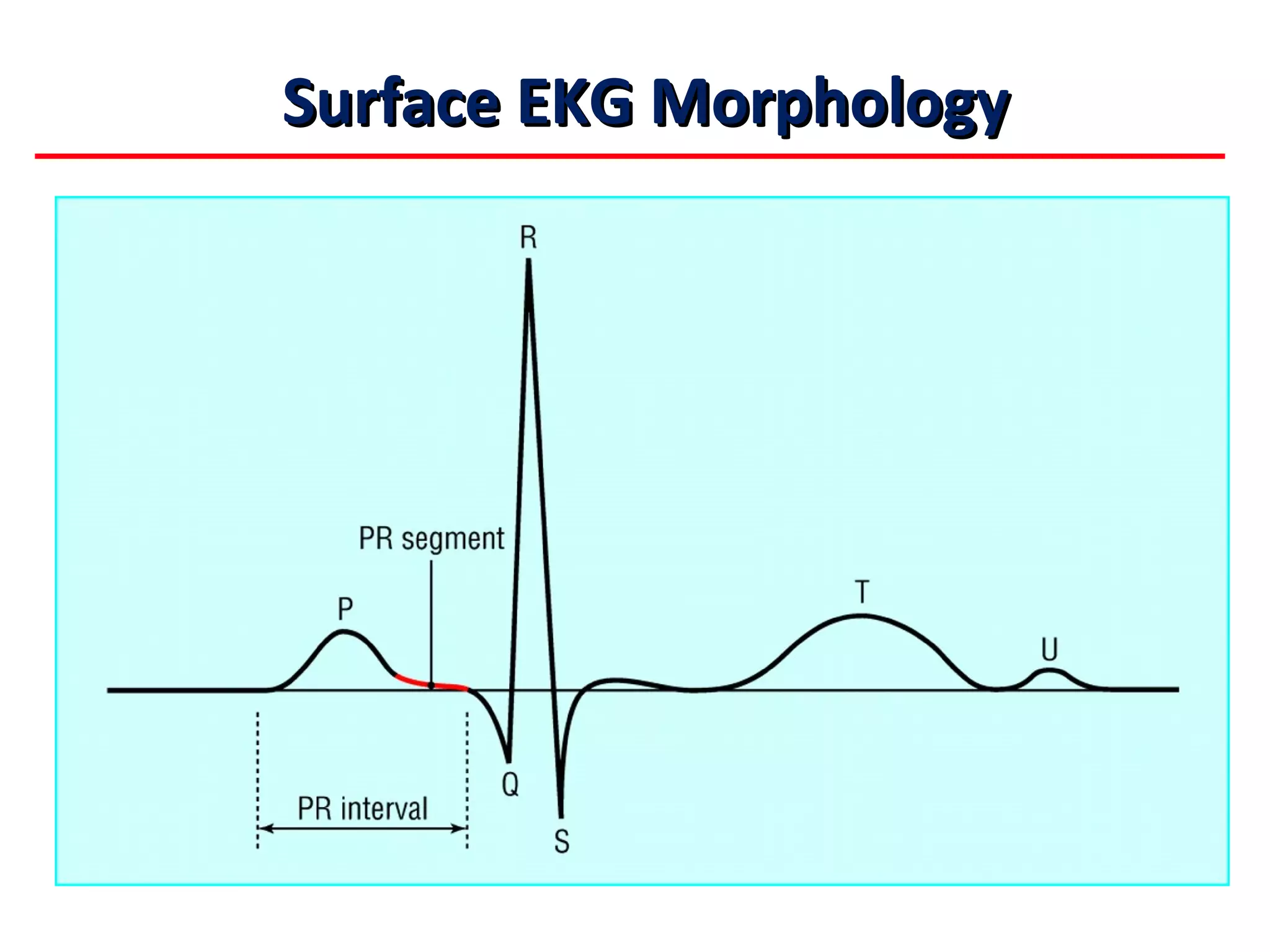 Basic Cardiac Electrophysiology and ECG Concepts_20120902_北區 | PPT