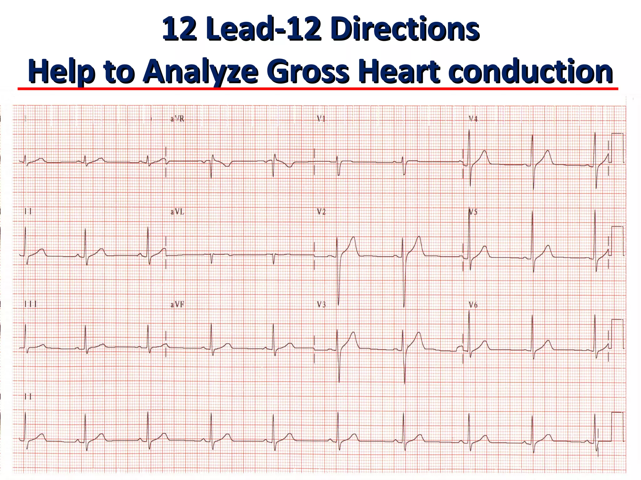 Basic Cardiac Electrophysiology and ECG Concepts_20120902_北區 | PPT