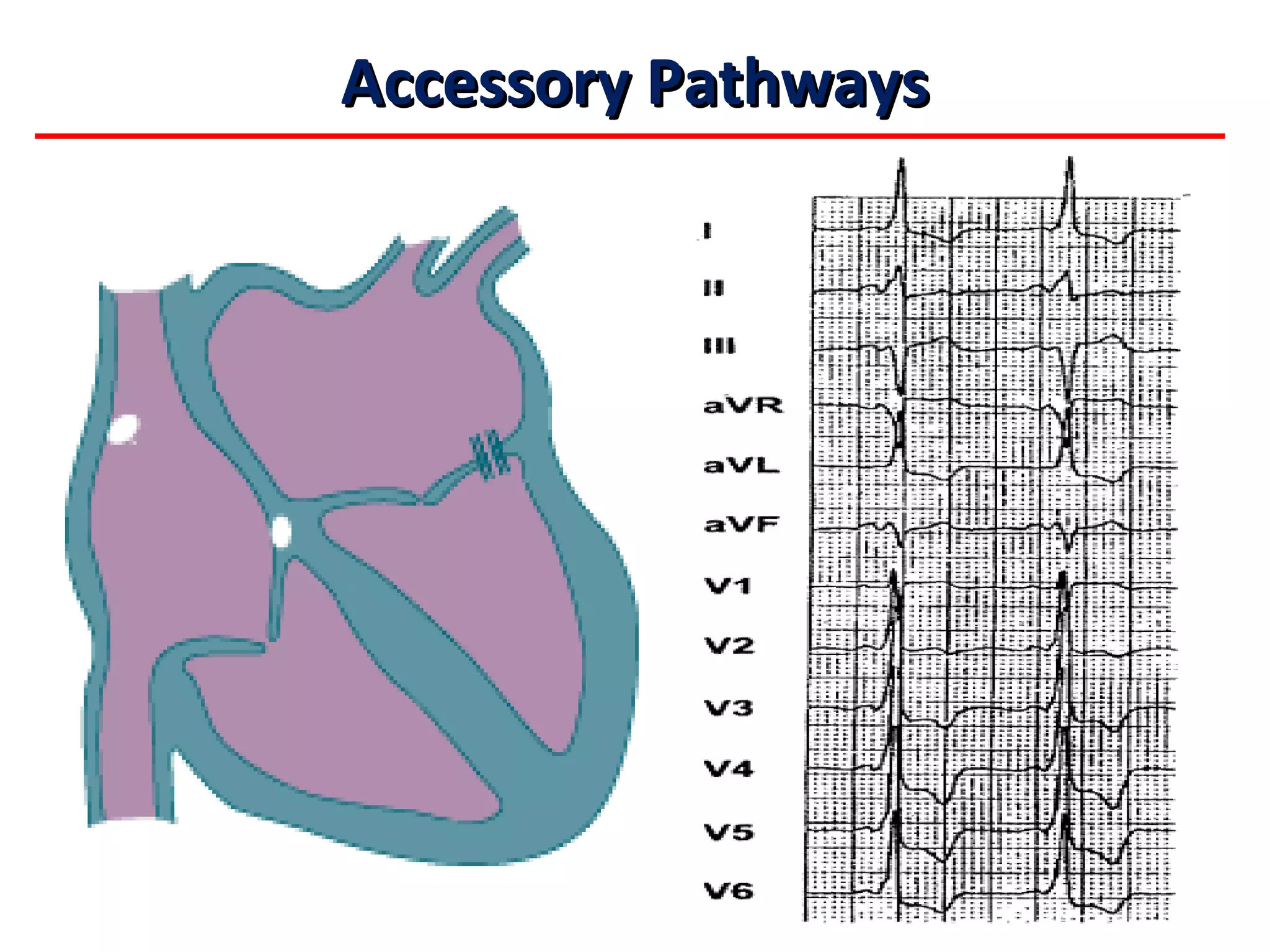 Basic Cardiac Electrophysiology and ECG Concepts_20120902_北區 | PPT