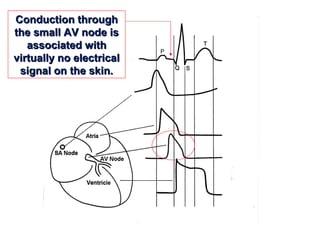 Basic Cardiac Electrophysiology and ECG Concepts_20120902_北區 | PPT