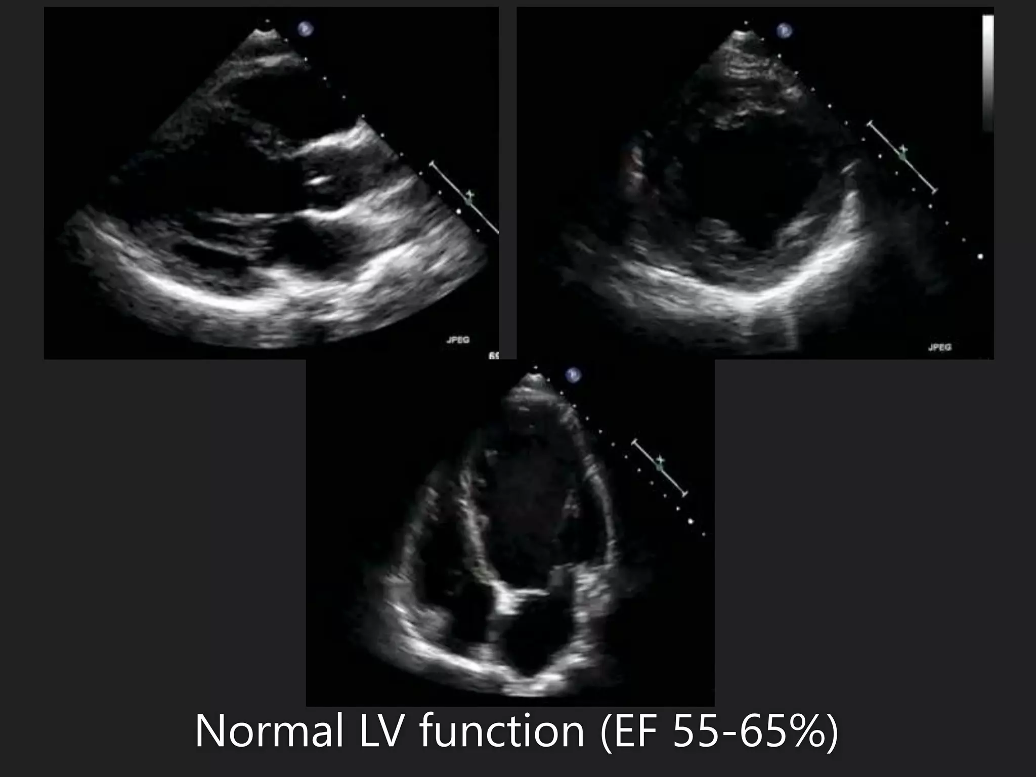 BASIC CARDIAC US.pptx