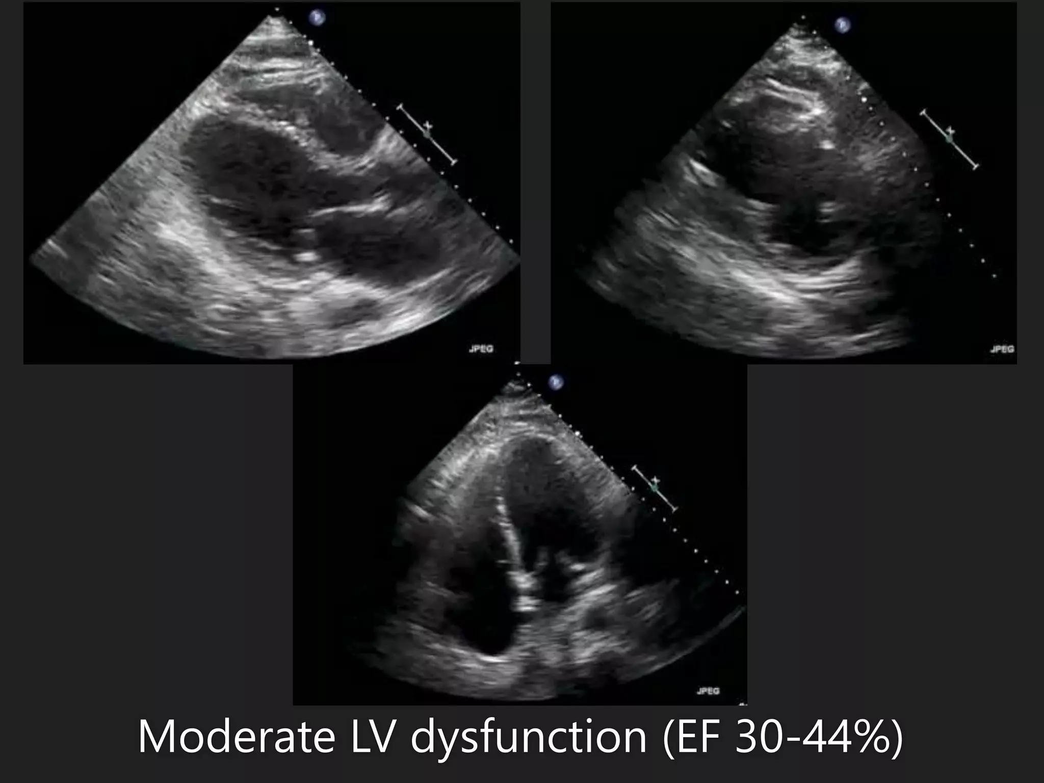 BASIC CARDIAC US.pptx
