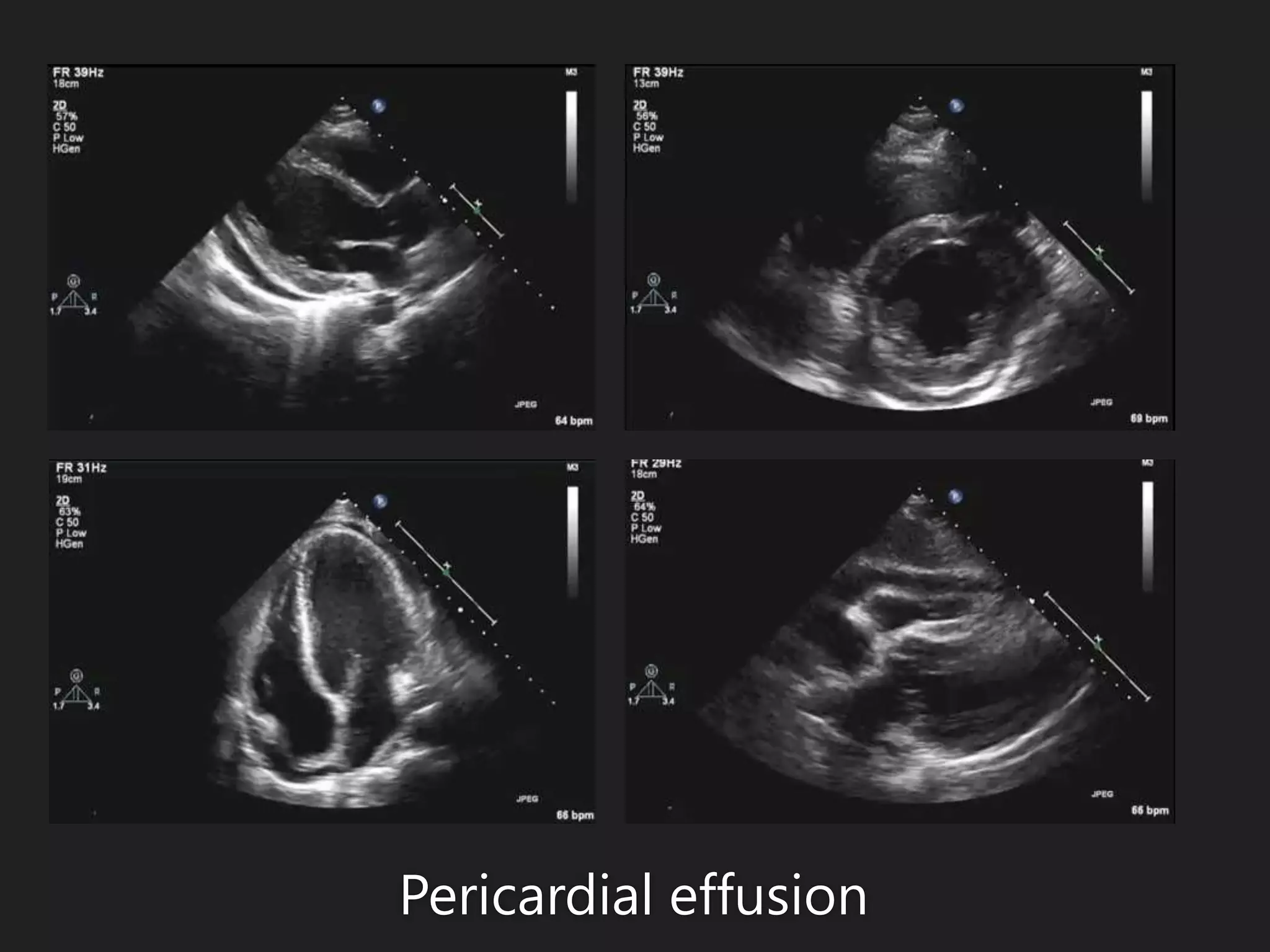 BASIC CARDIAC US.pptx