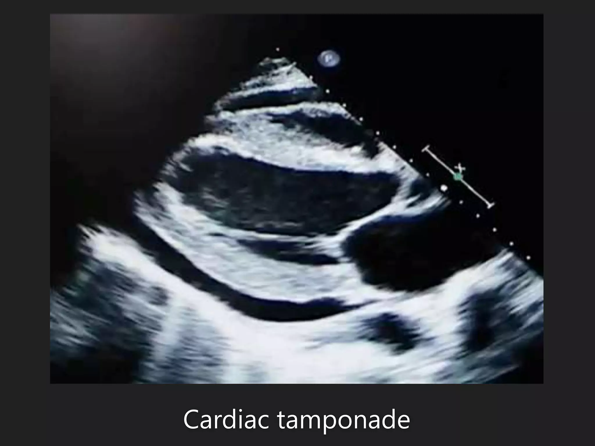 BASIC CARDIAC US.pptx