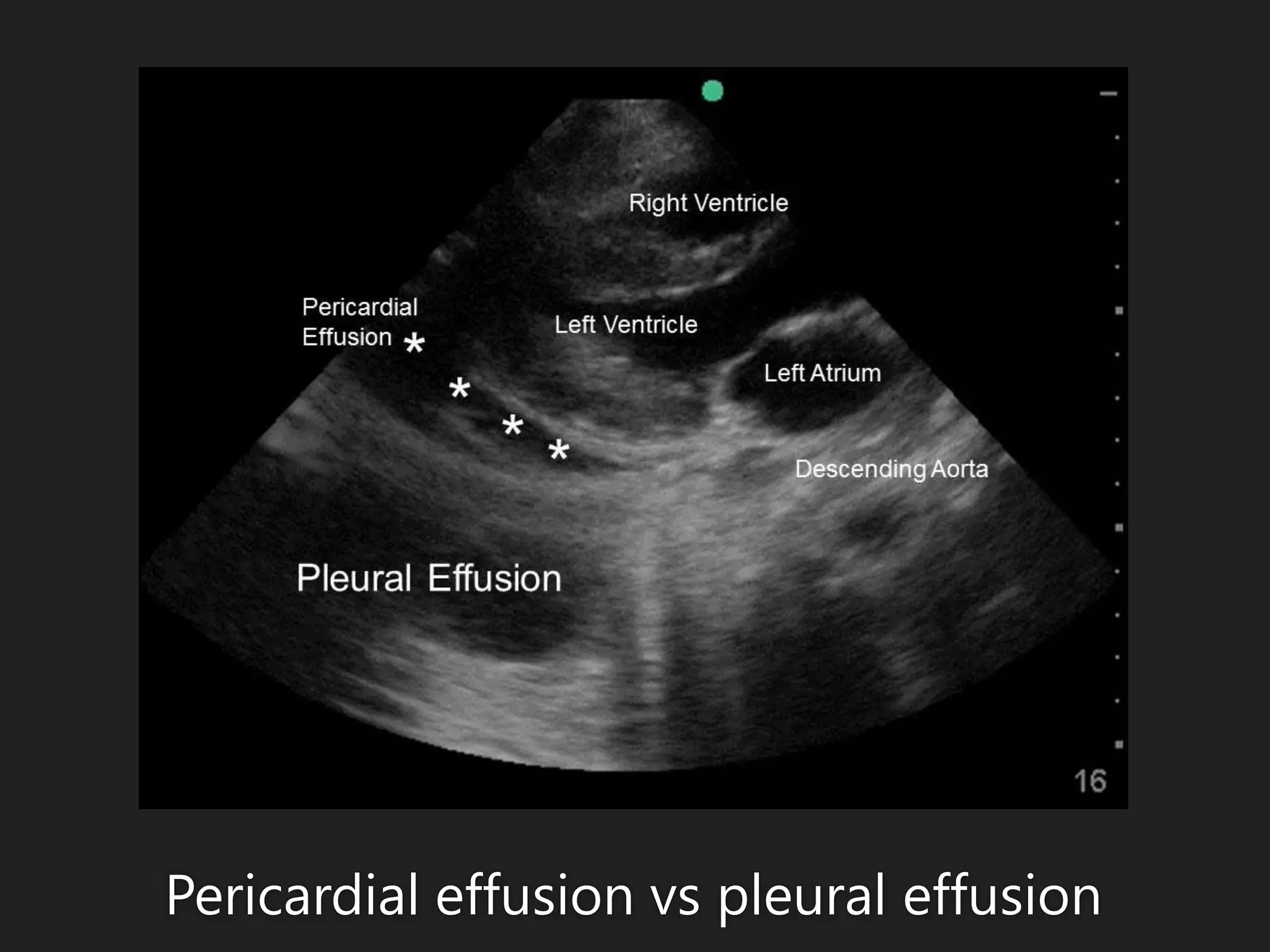 BASIC CARDIAC US.pptx