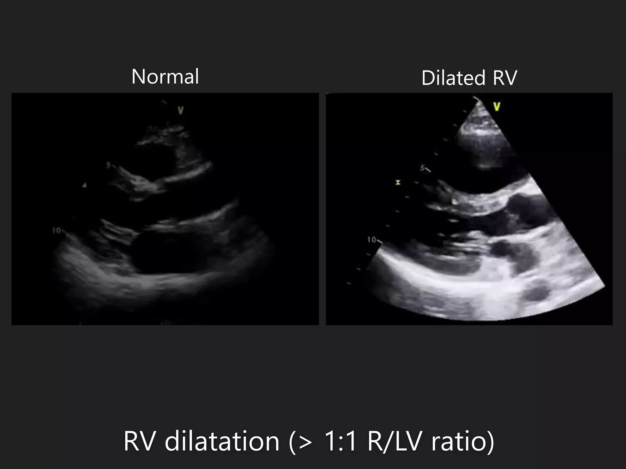 BASIC CARDIAC US.pptx