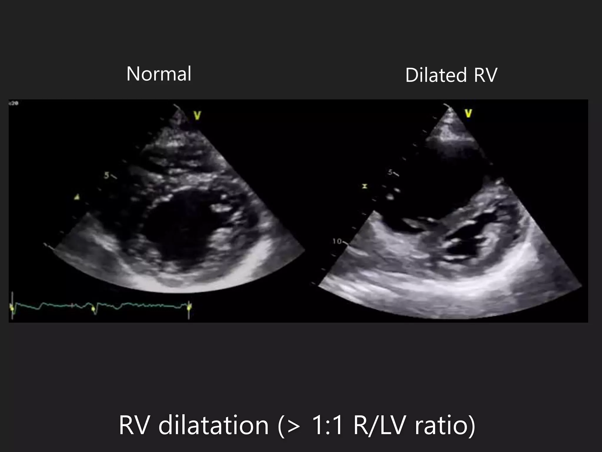 BASIC CARDIAC US.pptx