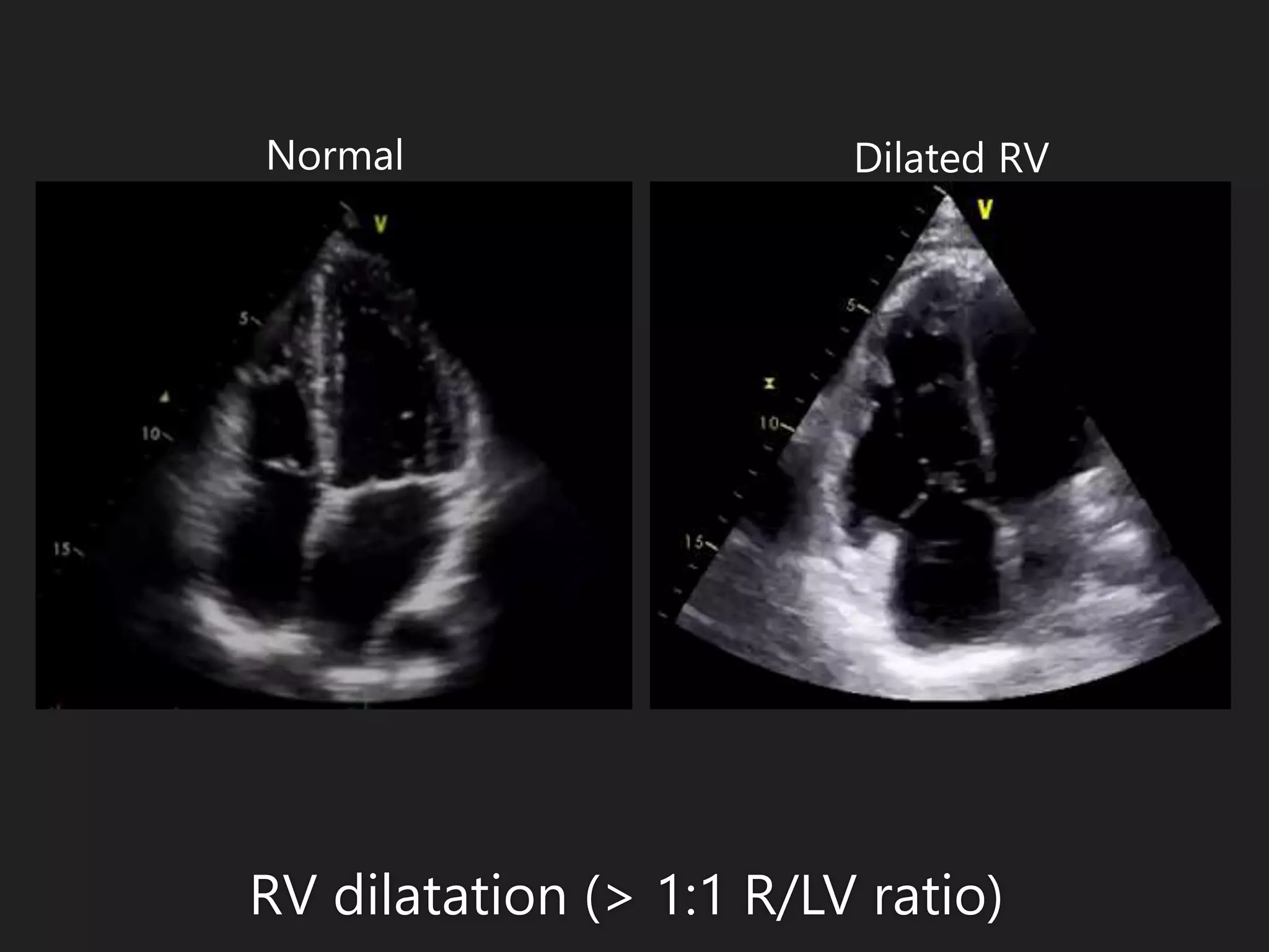 BASIC CARDIAC US.pptx