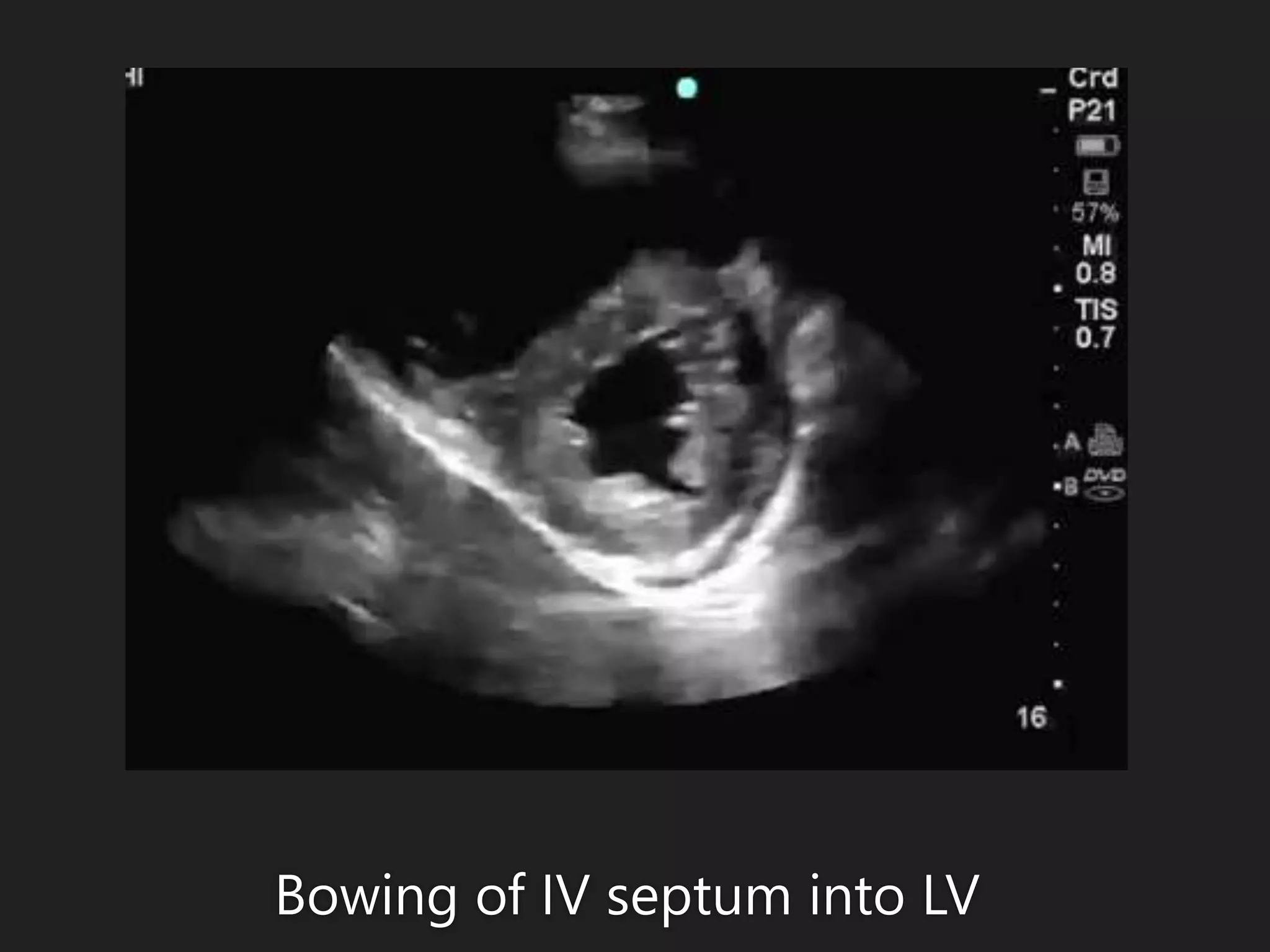 BASIC CARDIAC US.pptx