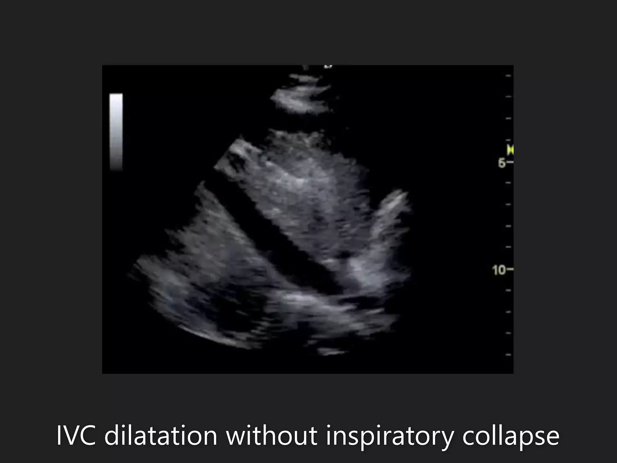 BASIC CARDIAC US.pptx