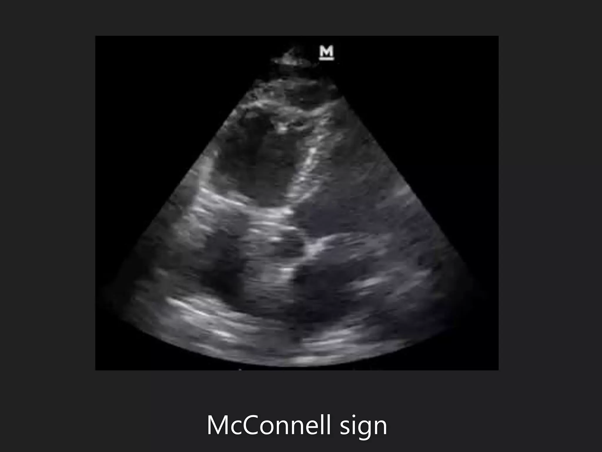 BASIC CARDIAC US.pptx