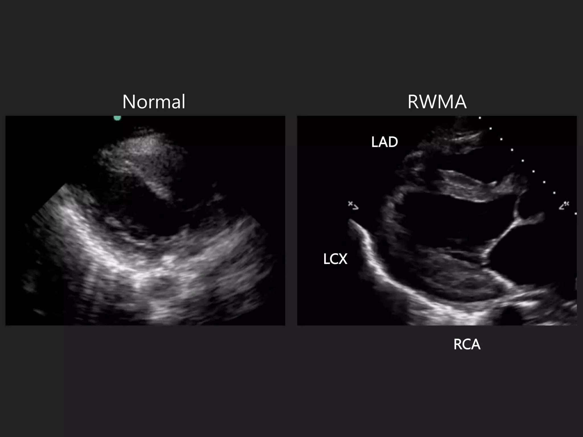 BASIC CARDIAC US.pptx