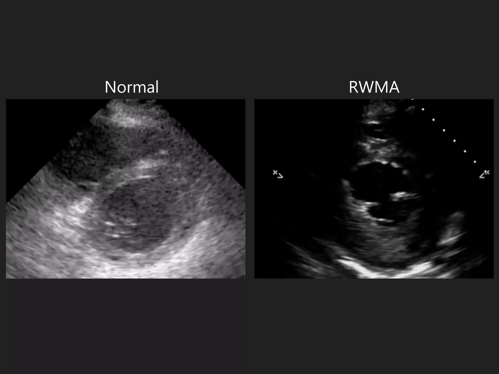 BASIC CARDIAC US.pptx