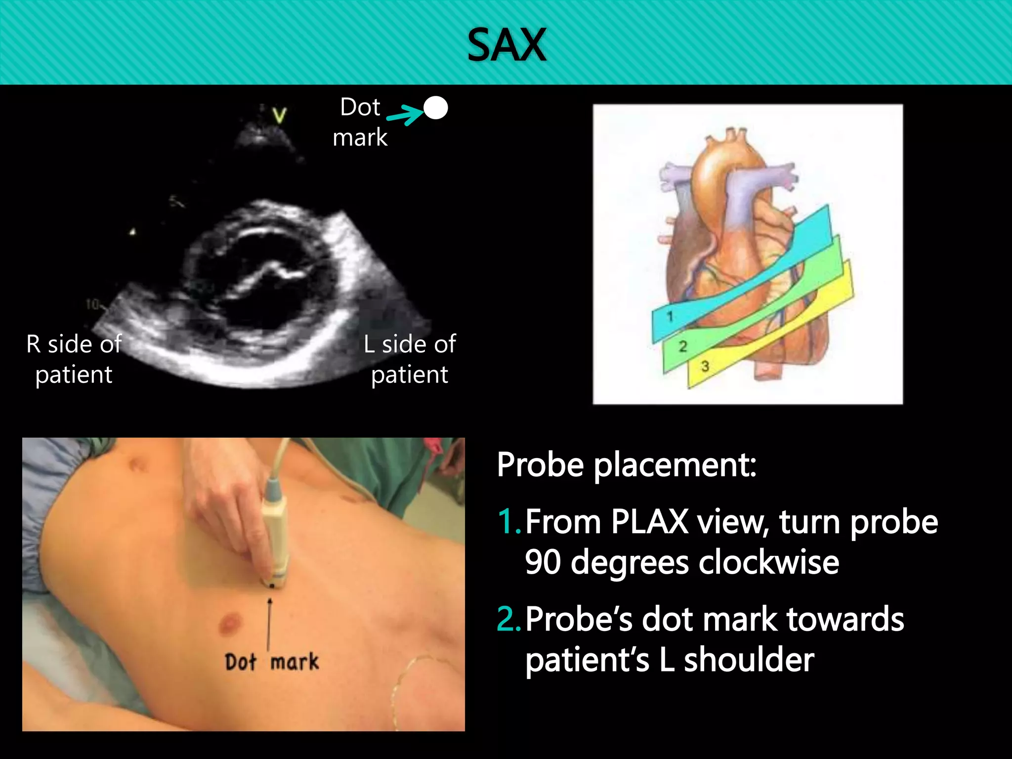 BASIC CARDIAC US.pptx