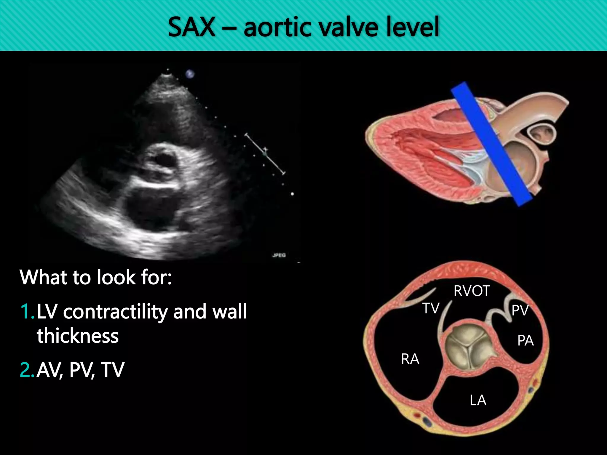 BASIC CARDIAC US.pptx