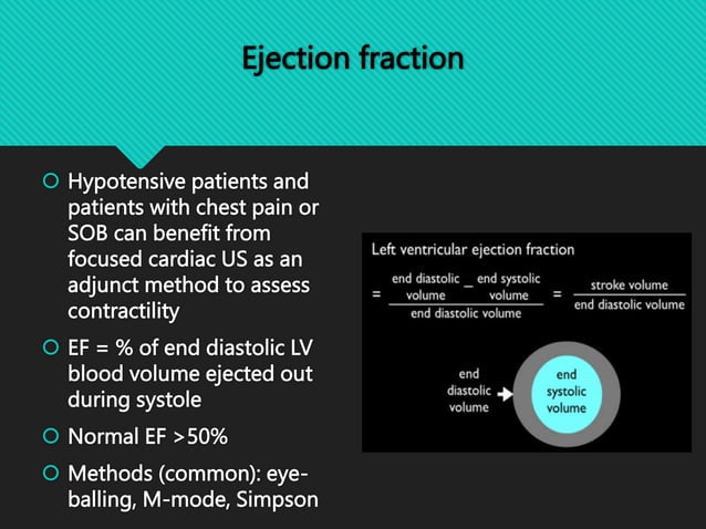 BASIC CARDIAC US.pptx