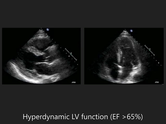 BASIC CARDIAC US.pptx