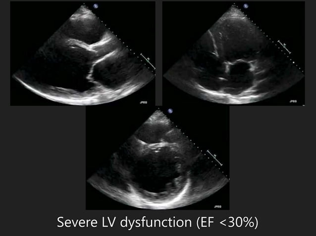 BASIC CARDIAC US.pptx