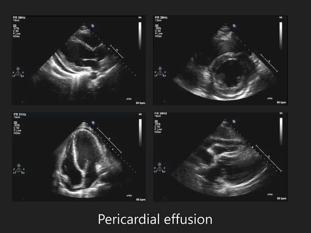BASIC CARDIAC US.pptx